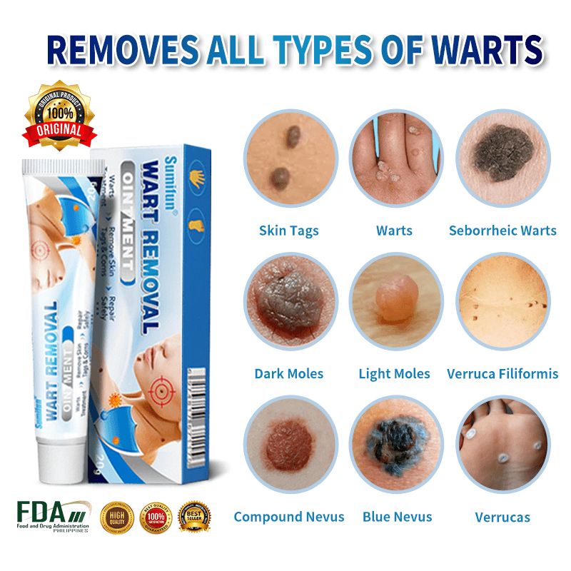 Warts Remover Original Warts Removal Cream Skin Tag Remover Warts ...