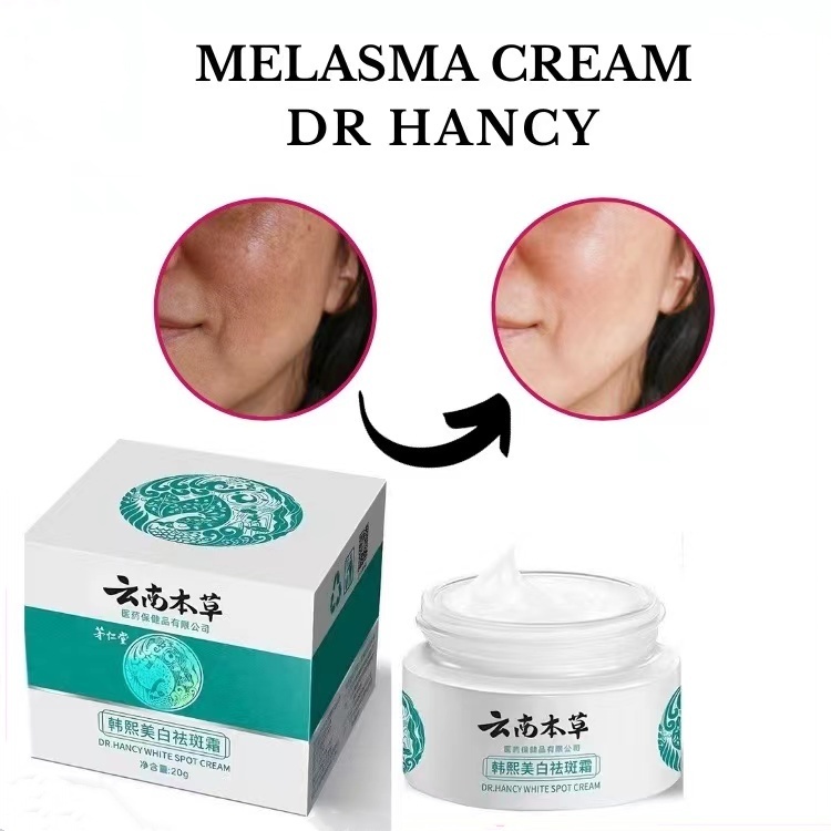 2023 HOT JAPANESE Melasma Cream White Spot Cream Skin Care Face ...