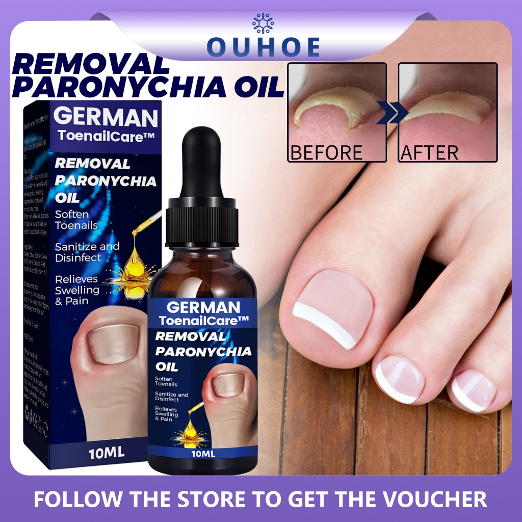 West&Month Removal Paronychia Oil Ingrown Toenail Treatment Nail Repair ...