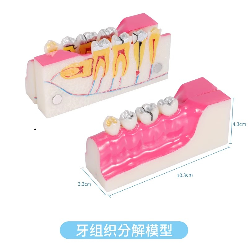 1: 1 Simulation Dental Posterior Teeth Decomposition Model Wisdom Tooth ...