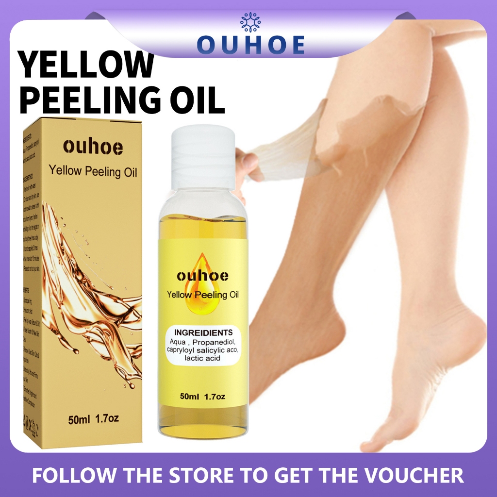 OUHOE Yellow Peeling Oil 50ml Peeling Lotion Body Whitening Bleaching ...