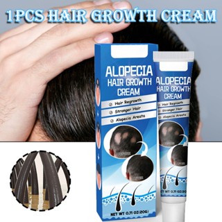 20g Alopecia Hair Growth Cream Anti Hair Loss Fast Growing Prevent Dry ...