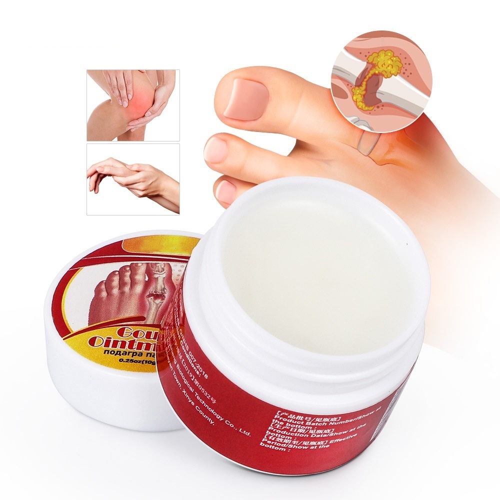 1PC Gout Treatment Ointment Joint Hallux Valgus Pain Relief Arthritis ...