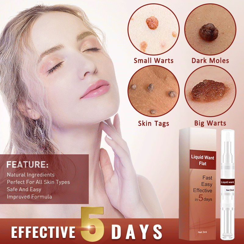 warts remover cream original skin tag remover Wart remover mole remover ...