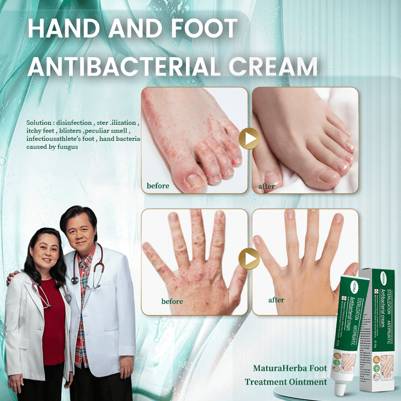 Anti Fungal Skin Fighter Cream Original For Itchi Skin Herbal Eczema ...