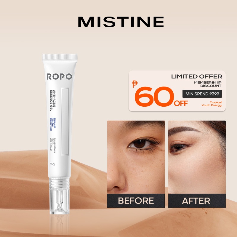 MISTINE X ROPO Acne Pimple Ready Stock Treatment Gel Blemish Skin Salicylic Acid Removal Remove ...