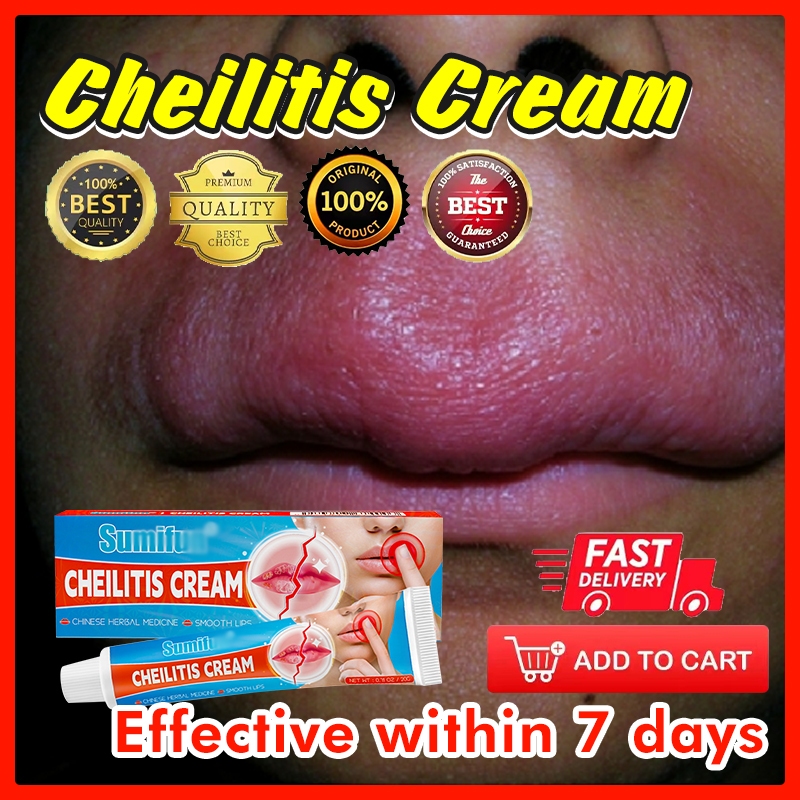 Cheilitis Treatment 20g Lip Care Lip Balm Therapy Repair Fade Lip Lines ...