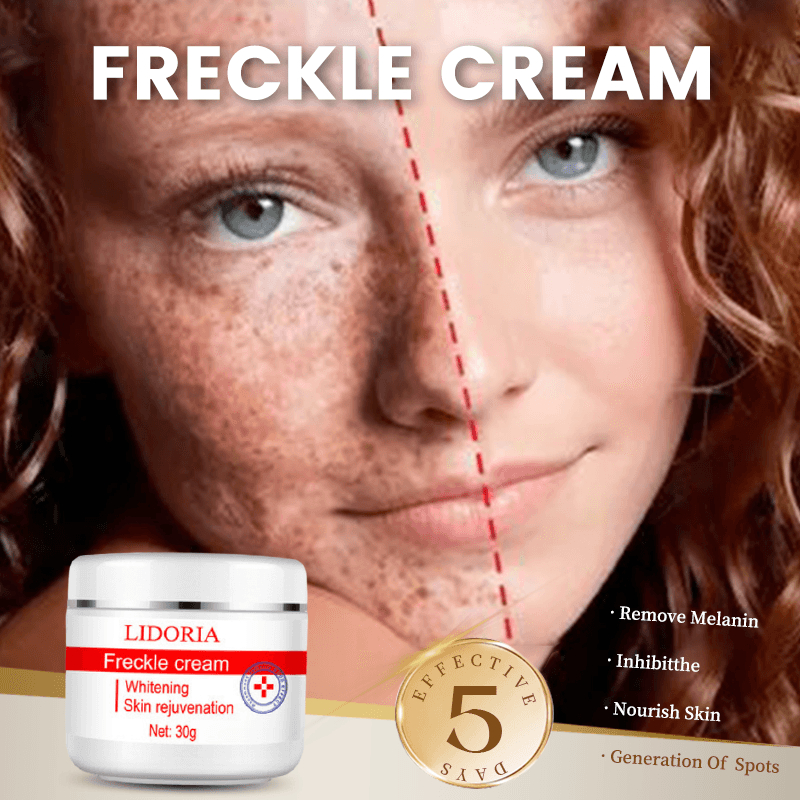 Muonly Holly Melasma Cream Pekas Remover Melasma Remover Cream Original ...