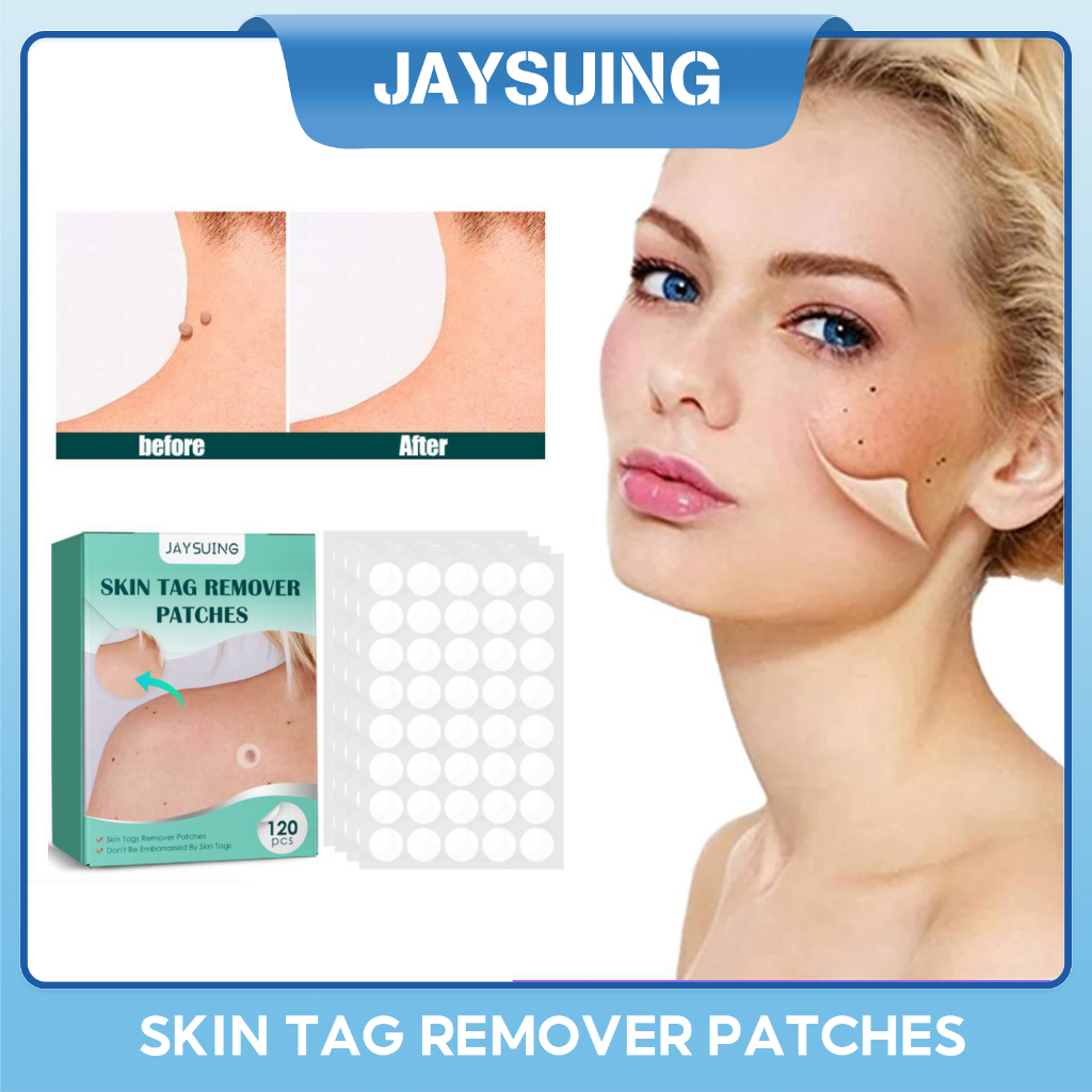Jaysuing Warts Remover Plaster 120Pcs Skin Tag Mole Corn Wart Removal ...