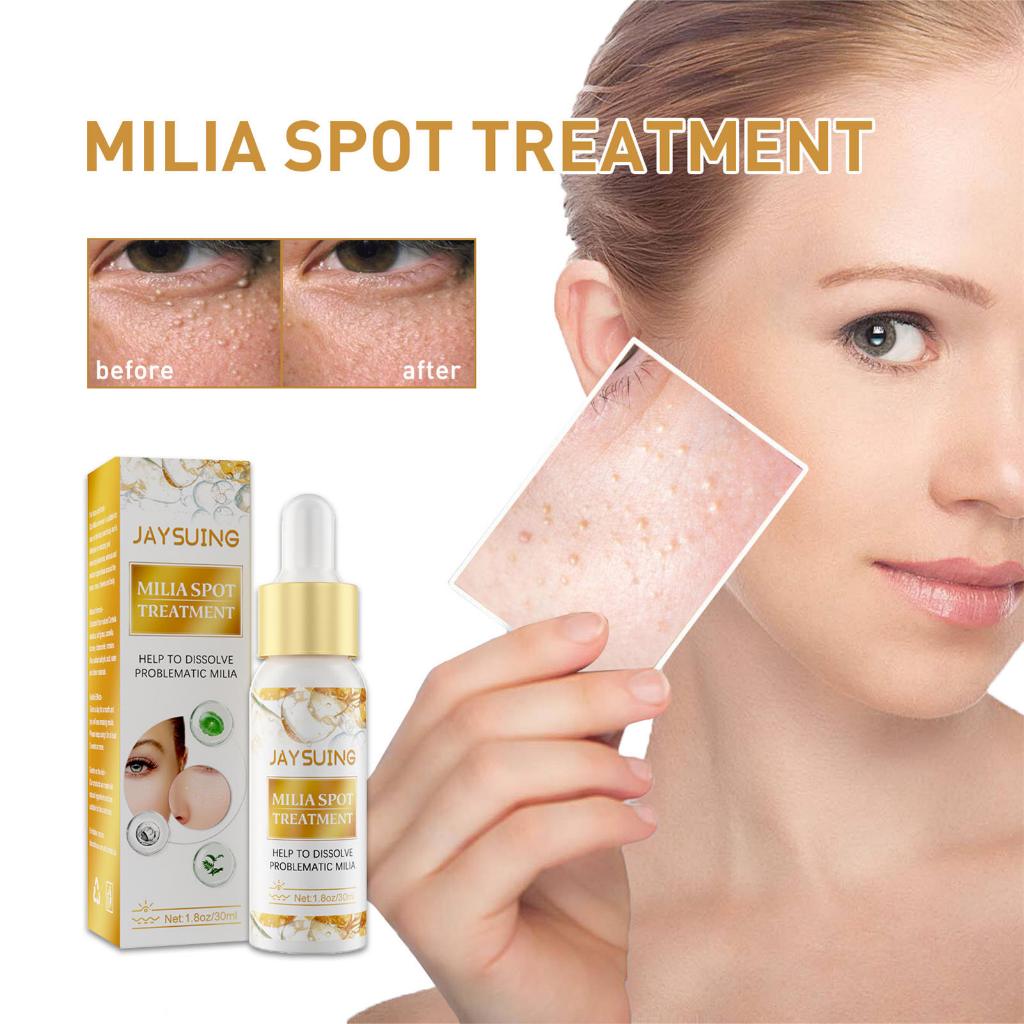 Eye Milia Removal Essential 30ml Eyes Dark Circle Correctordark Eye Circle Treatment Puffys Eyes