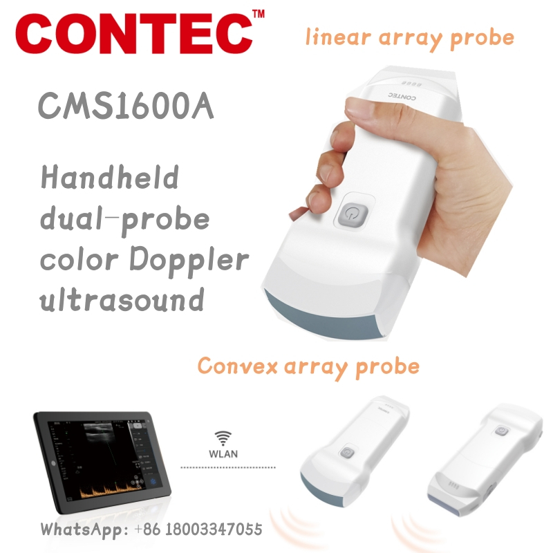 CONTEC CMS1600A handheld dual-probe color Doppler ultrasound diagnostic ...