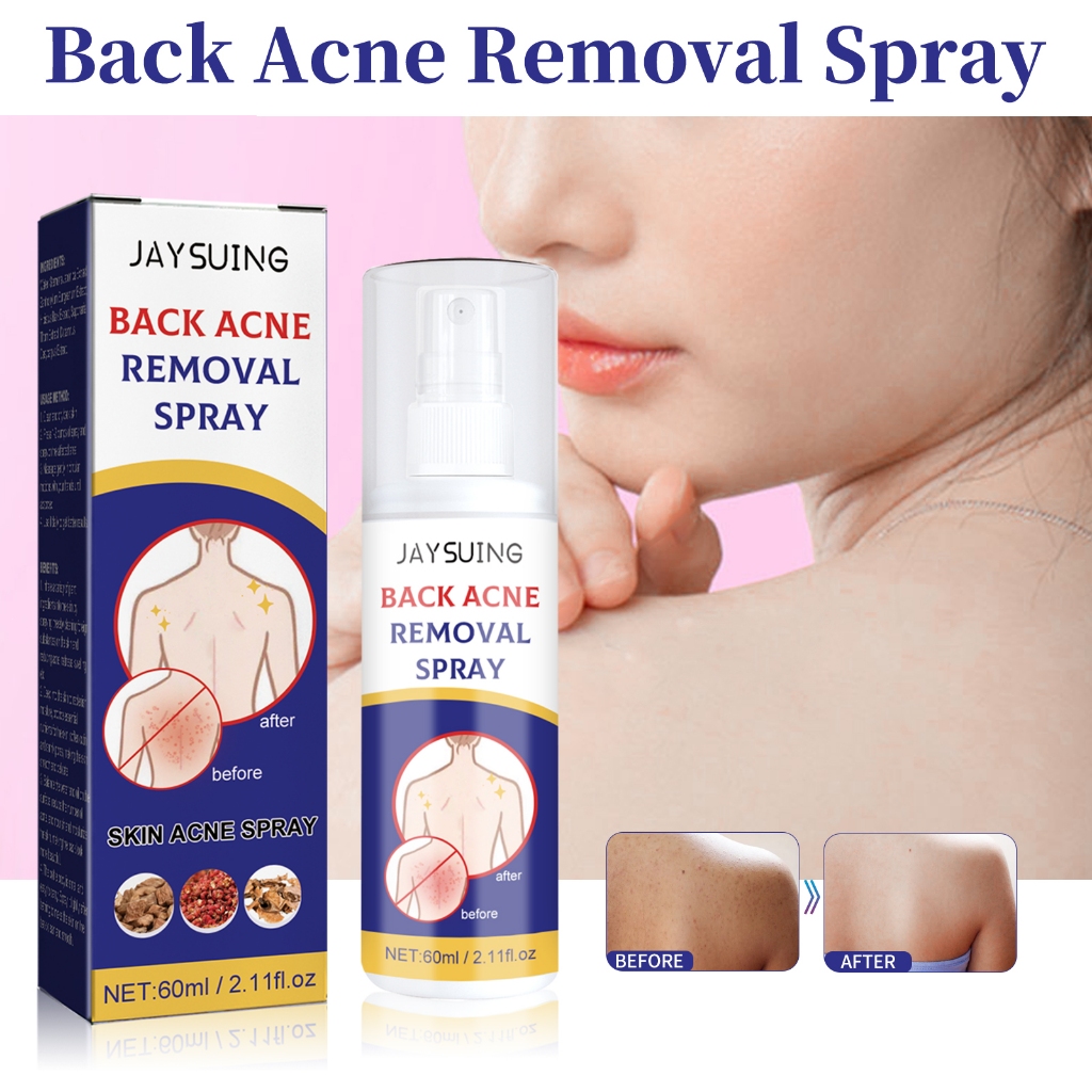 Jaysuing Back Acne Spray Acne Remover Spray Chest Back Anti Itching Oil