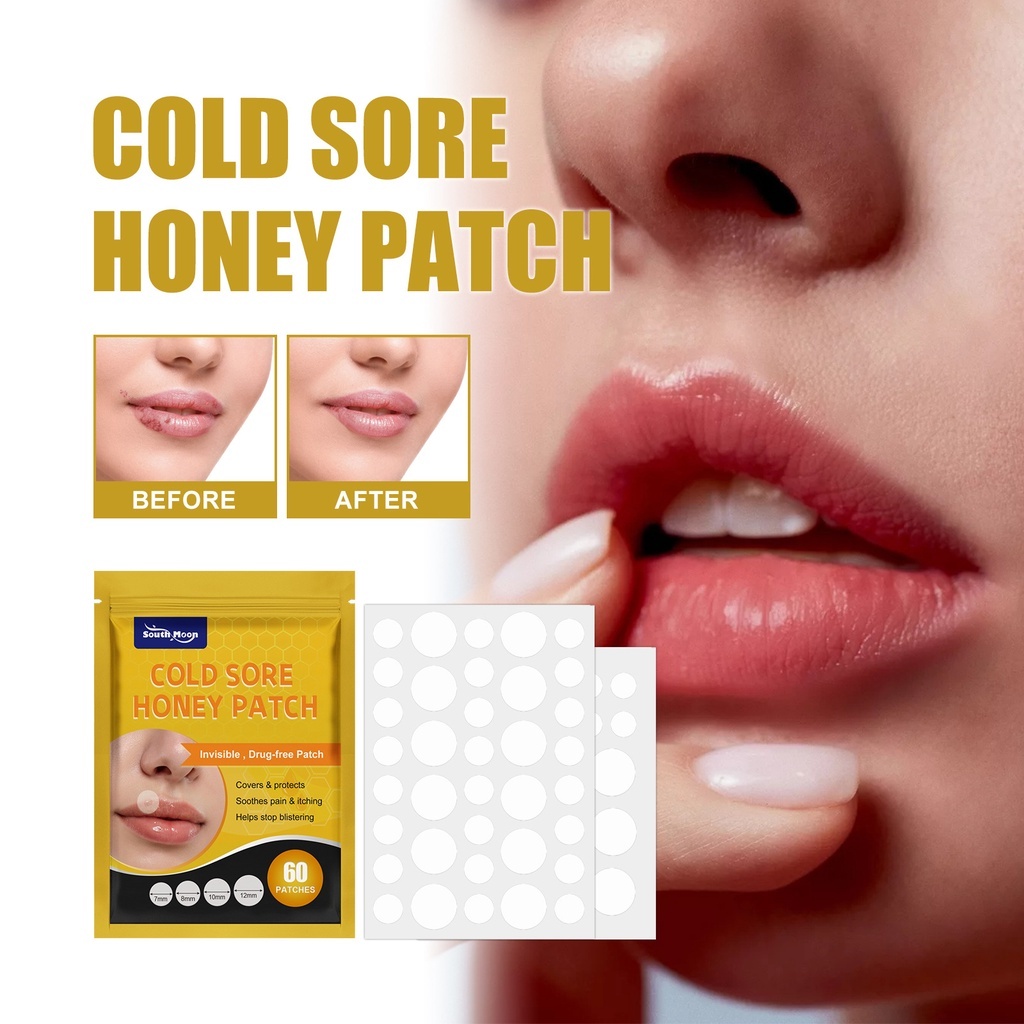 60pcs Cold Sore Lip Patch Multifunctional Mouth Ulceration Blisters ...