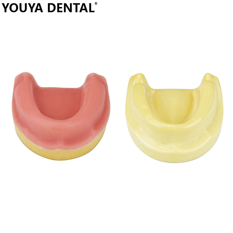 Dental Implant Restoration Teeth Model Upper Jaw Model Typodont No ...
