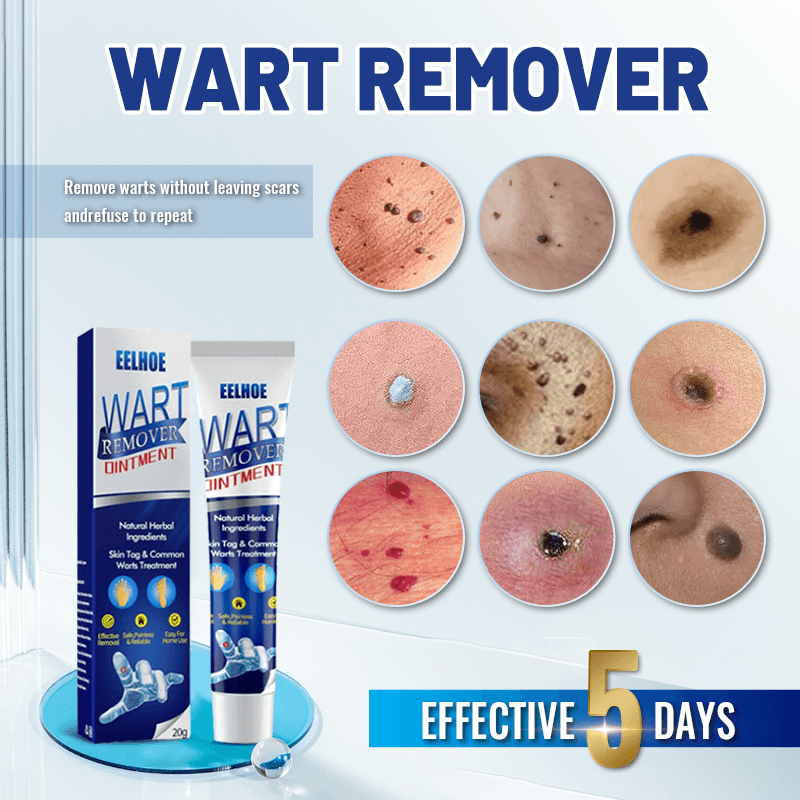 Muonly Holly Warts Remover ORIGINAL Cream Wart Removal Ointment Kulugo ...