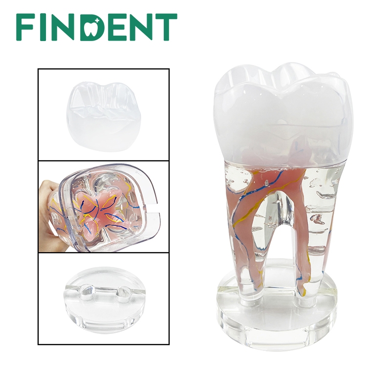 10 Times Endodontic Dental Model Detachable Teeth Model Large Clear ...