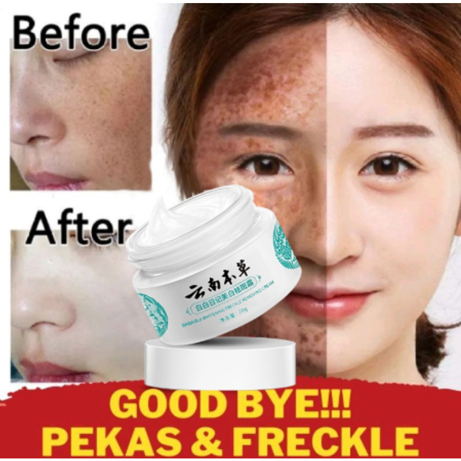 CT Japanese Melasma Cream 30g Replenish Collagen Whiting For Face Pekas ...