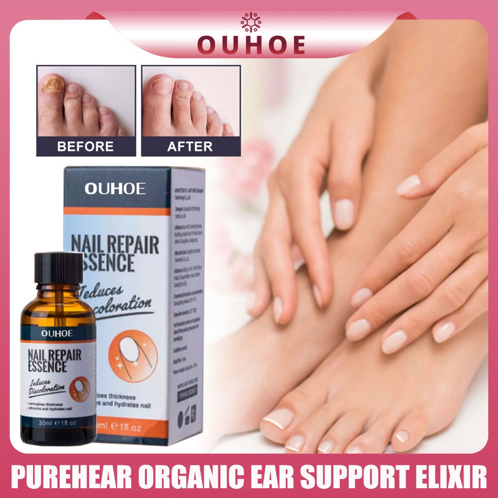 OUHOE Nail Repair Essence Fungal Nail Treatment Serum Soft Nail ...