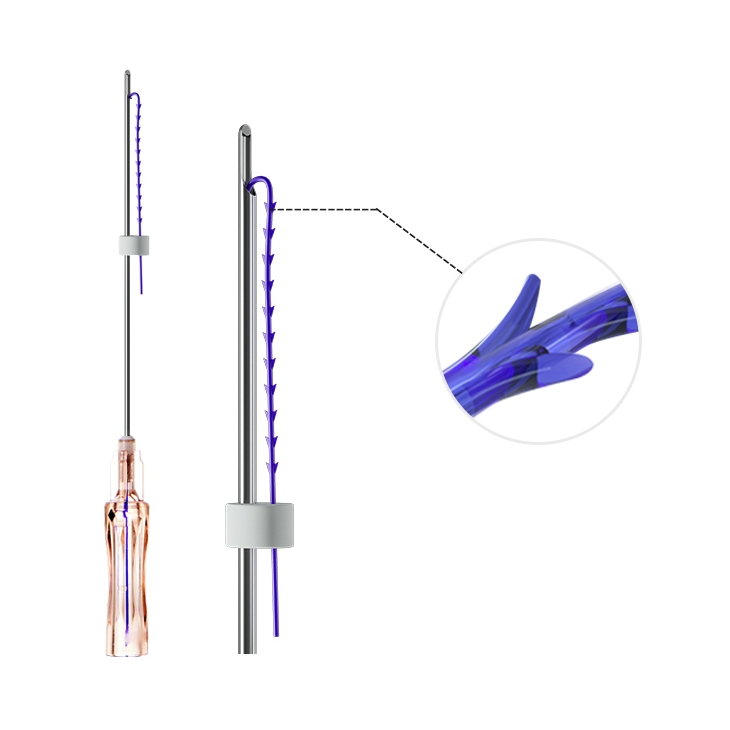 Uvela PDO Nose Thread Lift Half L-type Canula 19G38MM/19G6MM Cones Cog ...