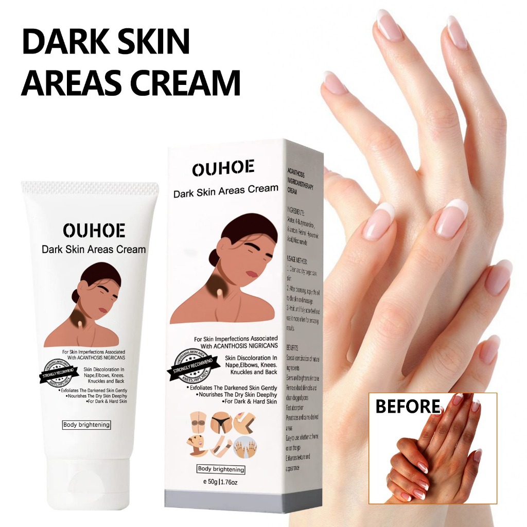 Ouhoe Dark Skin Areas Cream Niacinamide Body Whitening Cream Bleaching ...