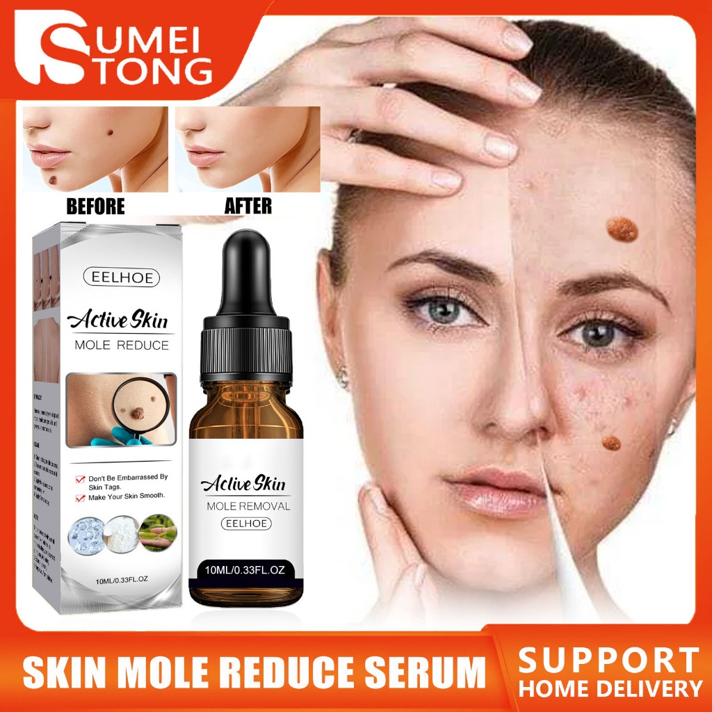 Eelhoe Active Skin Mole Reduce Serum Spot Removing Essence Face Mole ...