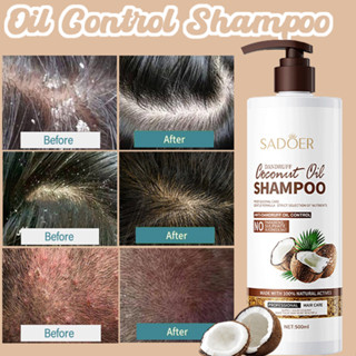【BUY 1 TAKE 1】Coconut Oil Shampoo Anti-Dandruff Repair Damage Hair Dry Hair Care Control Oil ...