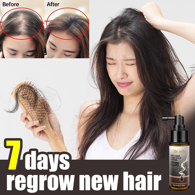 Fast Hair Growth Shampoo Anti-hair Loss Shampoo Growth Serum Essence ...
