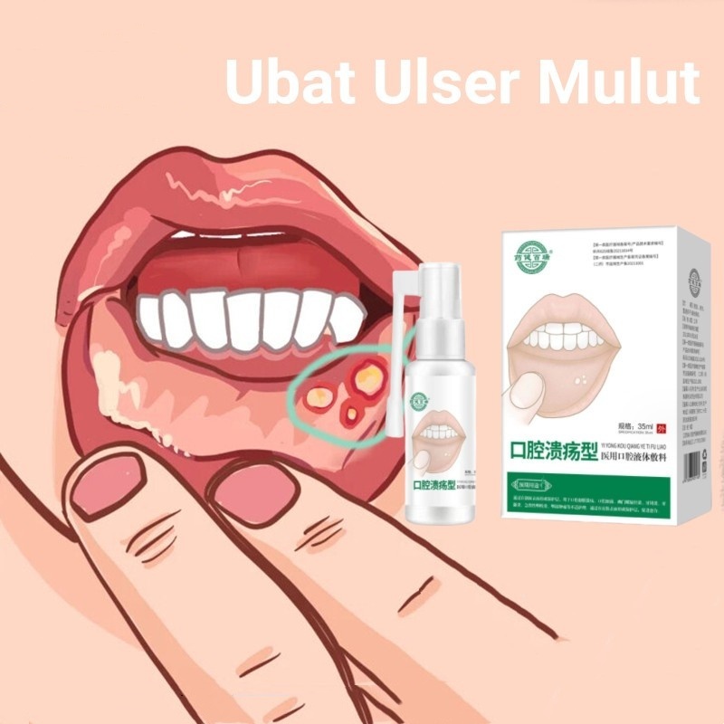 Ubat Ulser Mulut Oral Ulcer Mouth Ulcer Spray Canker Sore Treatment ...