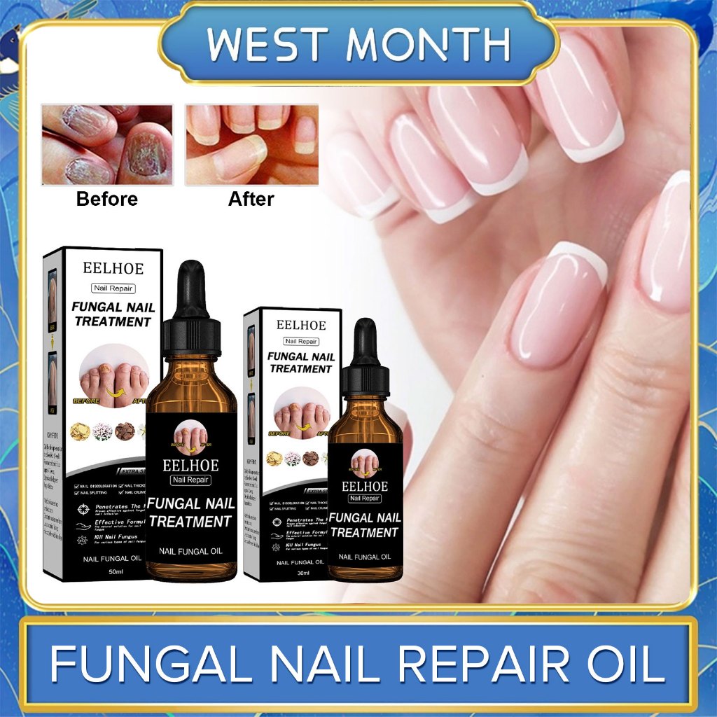 Nail Repair Liquid Anti Fungal Infection Remove Bright Nail Care ...