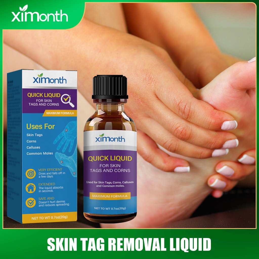 Ximonth Corn Remover Spray Foot Corn Removal Spray Repairing Skin ...