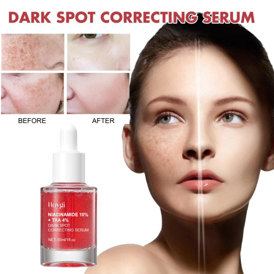 niacinamide serum jeragat degil berkesan anti freckles whitening serum ...