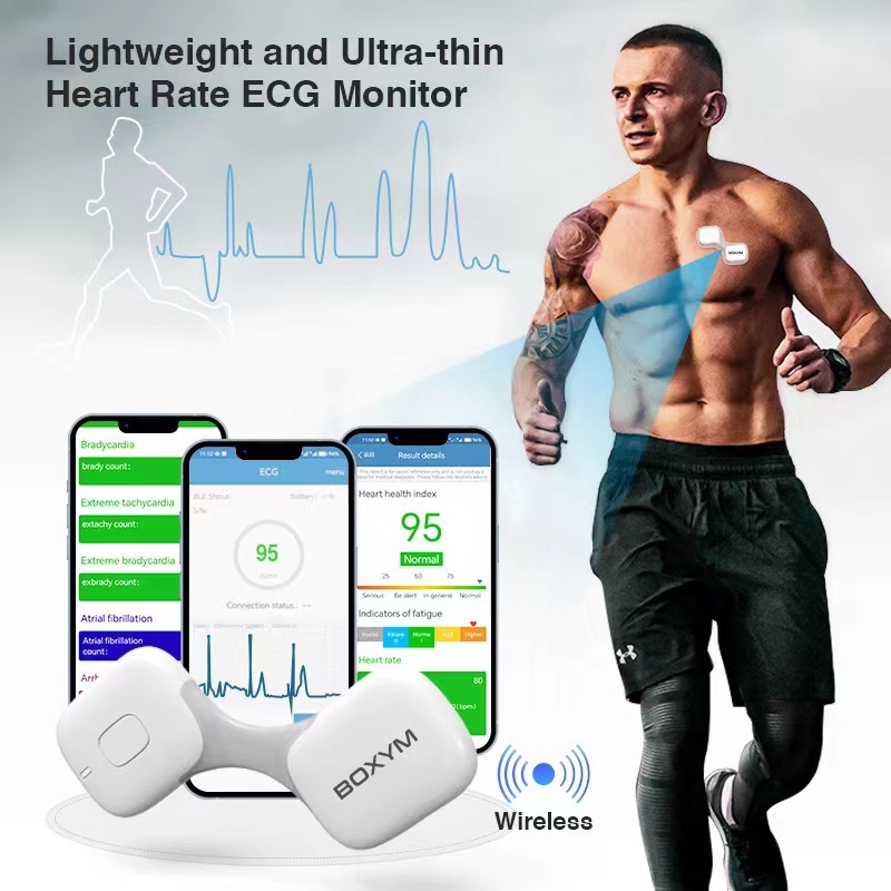 36 Hour Heart Rate ECG EKG Bluetooth Charge Holter ECG Monitor Data ...