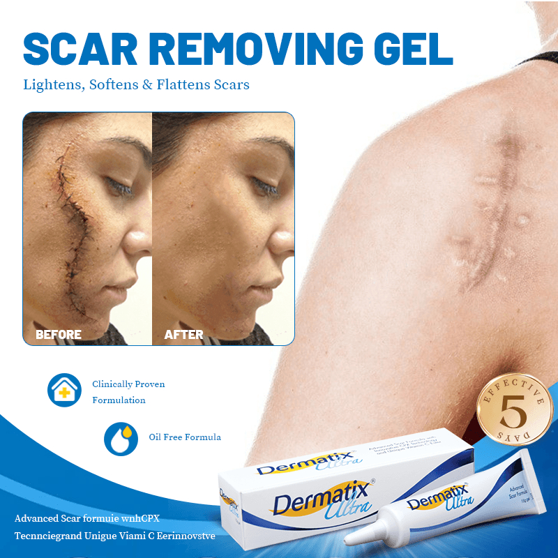 Dermatix Ultra Scar Remover Cream For Leg Keloid Old Scars Removal ...