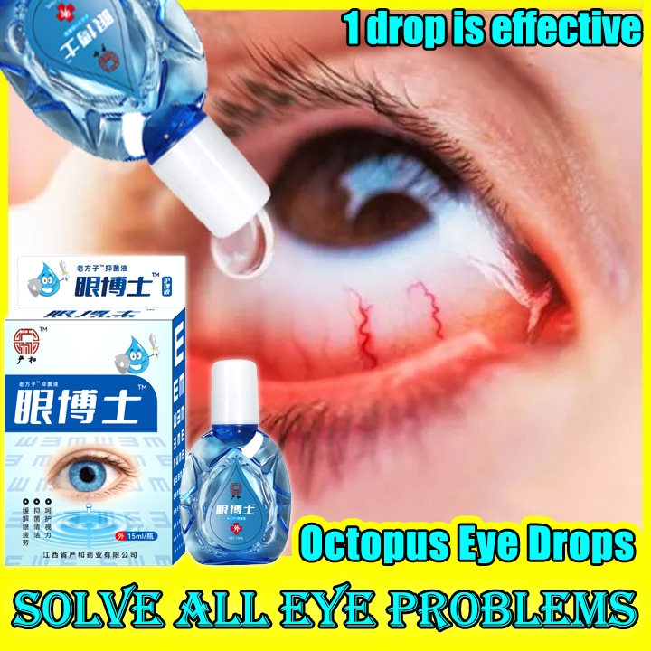 eye drops for eye cmd/bioline eye drops contact lens eye care for dye ...