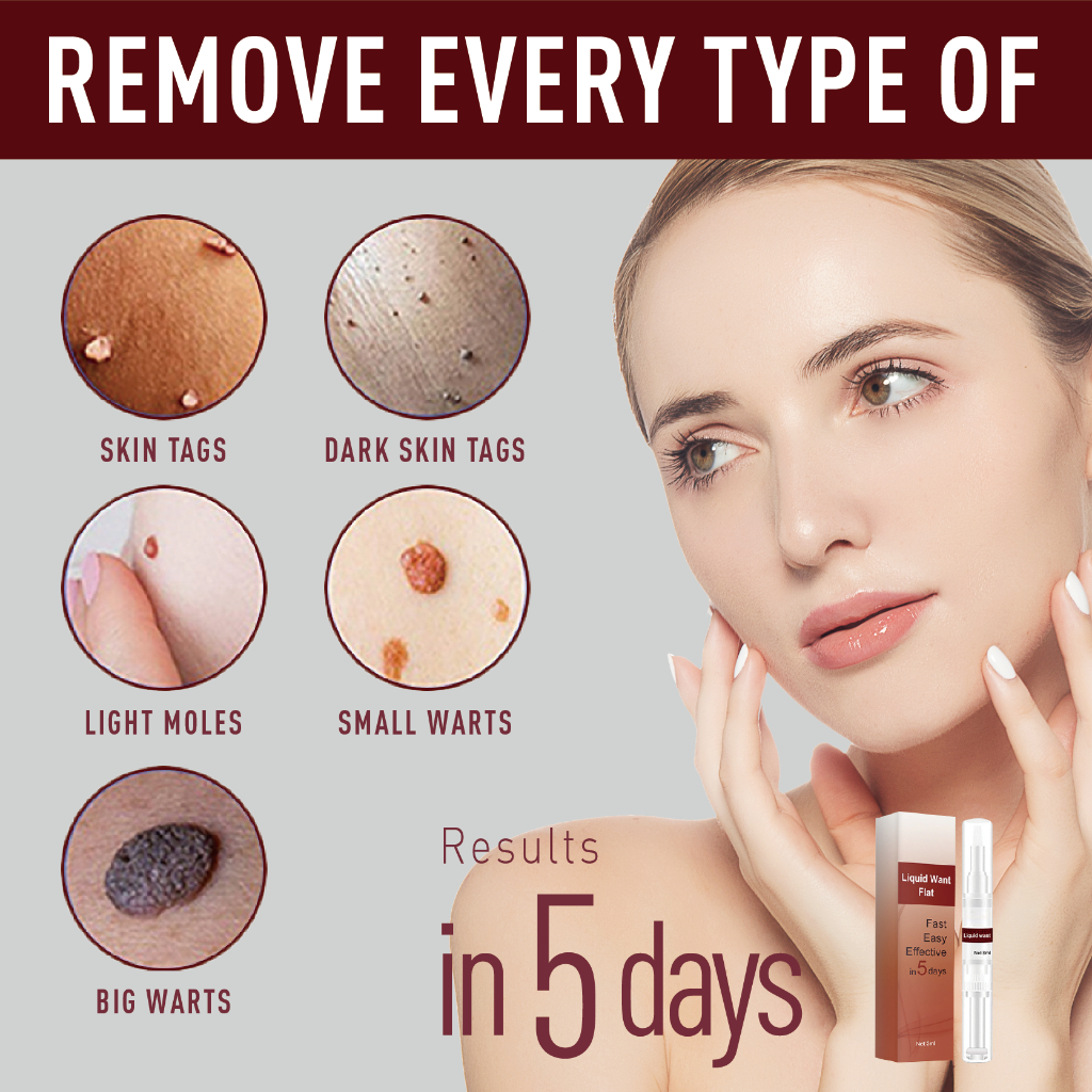 Remover Facial Skin Tag Removal Pen Foot Corn Plantar Wart Papillomas ...