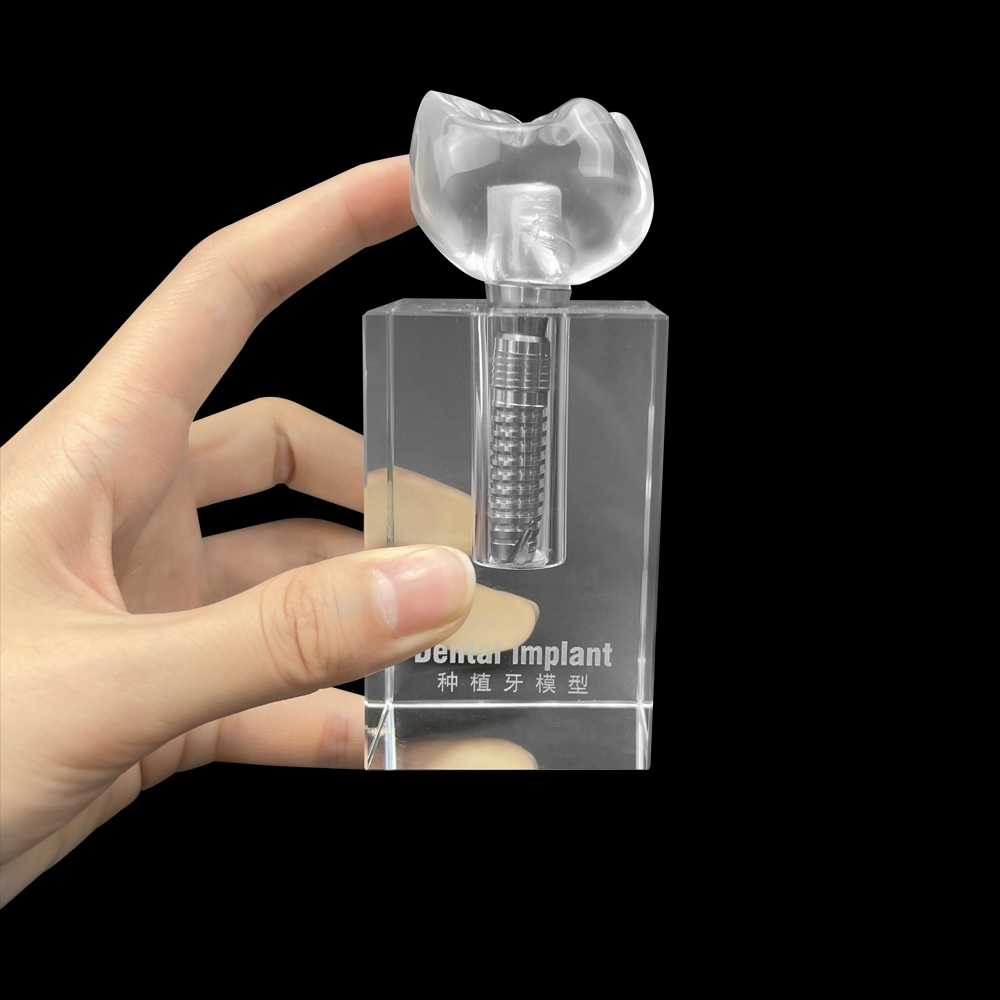 For Practice Training Teaching Study Demo Detachable Dental Implant ...