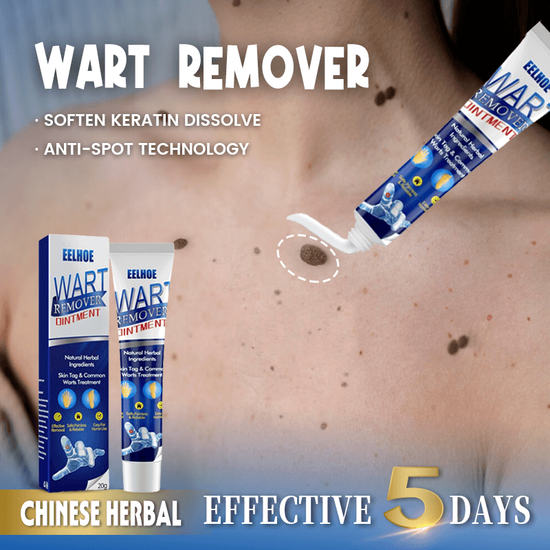 Warts Remover ORIGINAL Cream Wart Removal Ointment Kulugo Skin Tags ...