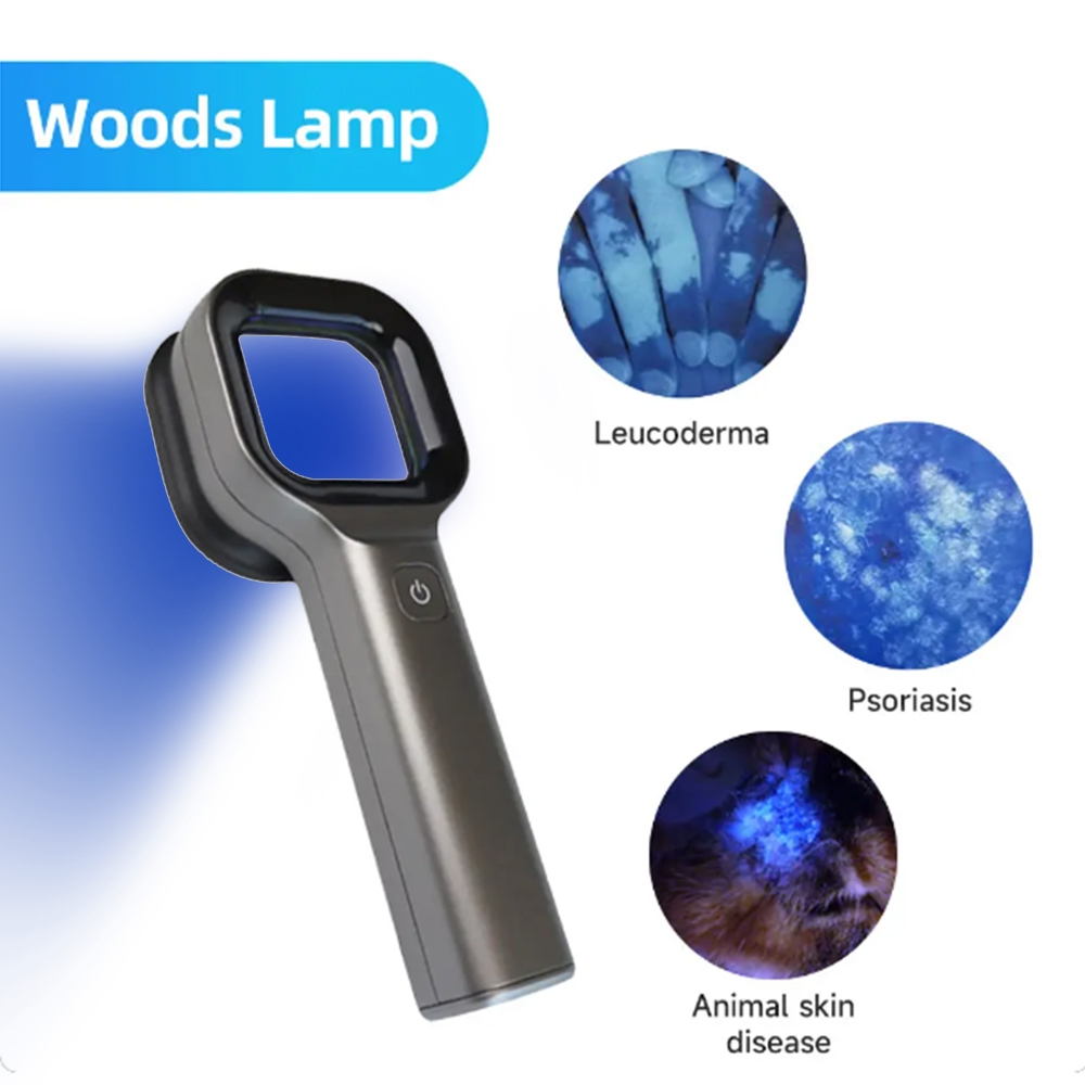YONKER Medical Woods Lamp Skin Examination Skin Fungus Detector ...