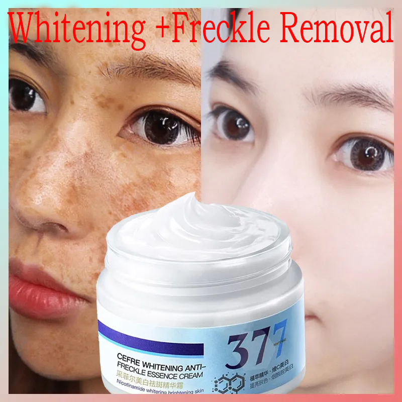 377 Genesis Spot Whitening Cream Skin Face Light Dark Spots Brightening ...