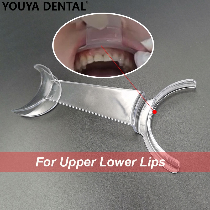 Intraoral Opener Spreader Double Head Lip Retractor Intraoral Black ...