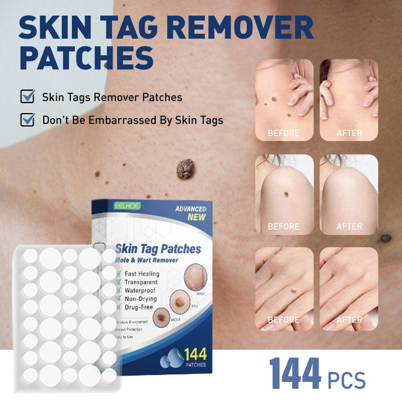 Warts Remover Patch Safe Painless Skin Tag Remover Patch Fast Acting ...