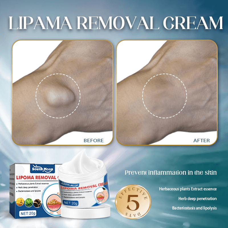 Lipoma removal cream original lipoma ointment japan lipoma cream ...