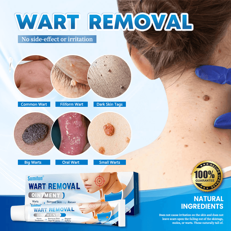Warts Remover Original Warts Removal Cream Skin Tag Remover Warts ...