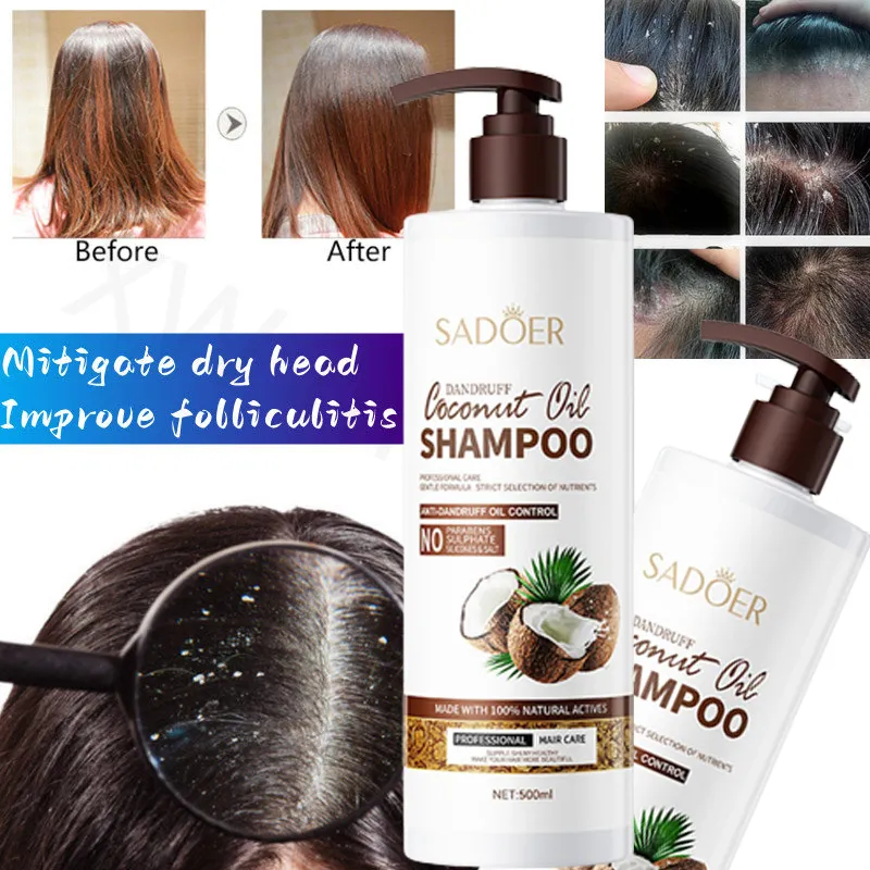 Coconut Oil Shampoo Moisturizing Hair Care Dandruff Shampoo Anti-itching Anti Hair Loss 500ML ...