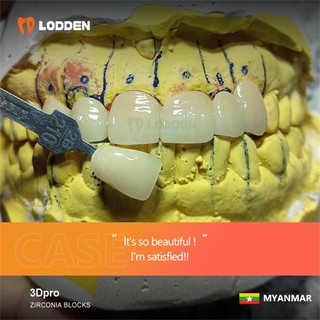 LODDEN 3D Pro Multilayer 98x20mm Zirconia Blocks Dental Lab Material ...