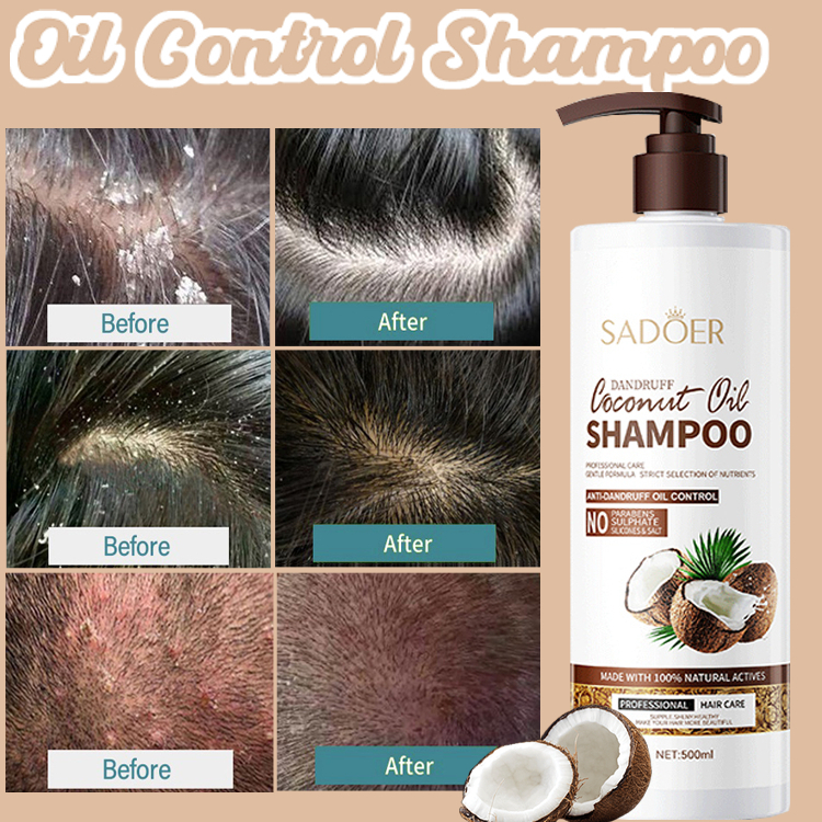 SADOER Coconut Oil Shampoo Deep Cleaning Anti-Dandruff Repair Damage Hair Dry Hair Care ...