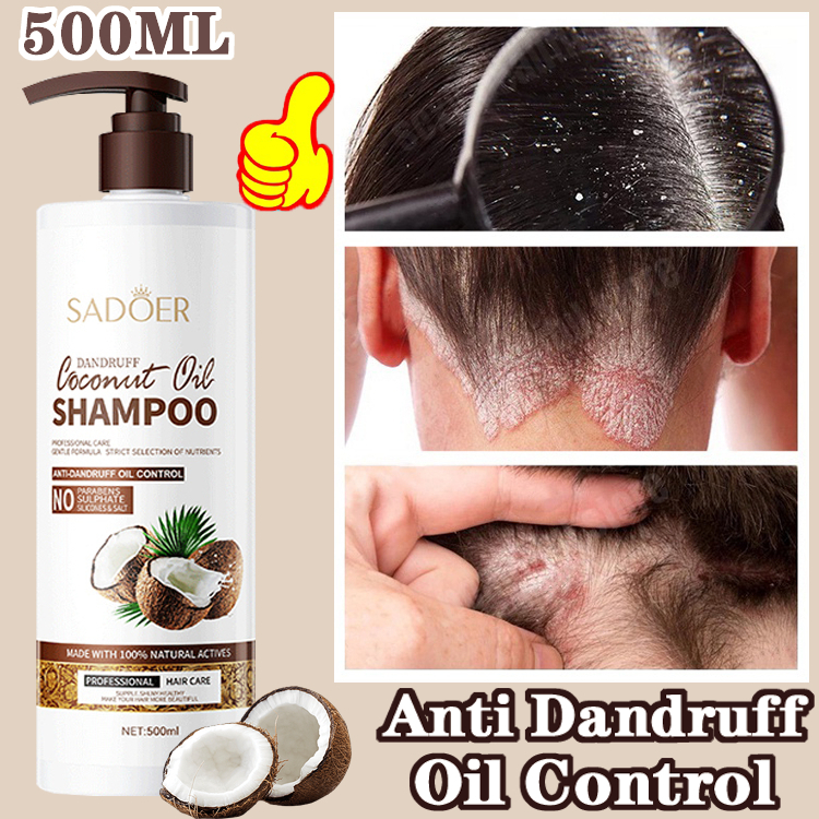 SADOER Coconut Oil Shampoo Deep Cleaning Anti-Dandruff Repair Damage Hair Dry Hair Care ...