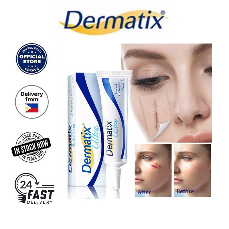 Dermatix Ultra acne Scar Formula Acne Treatment Remove Stretch Marks ...