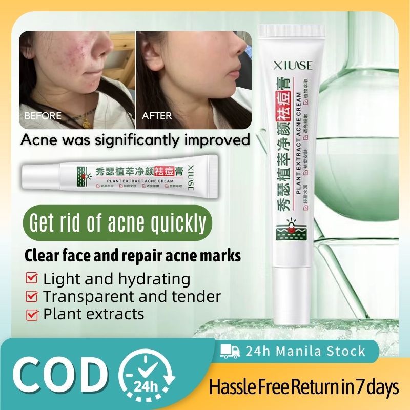 Acne Cream Plant Extract Purifying Refining Skin Improves Skin Acne ...