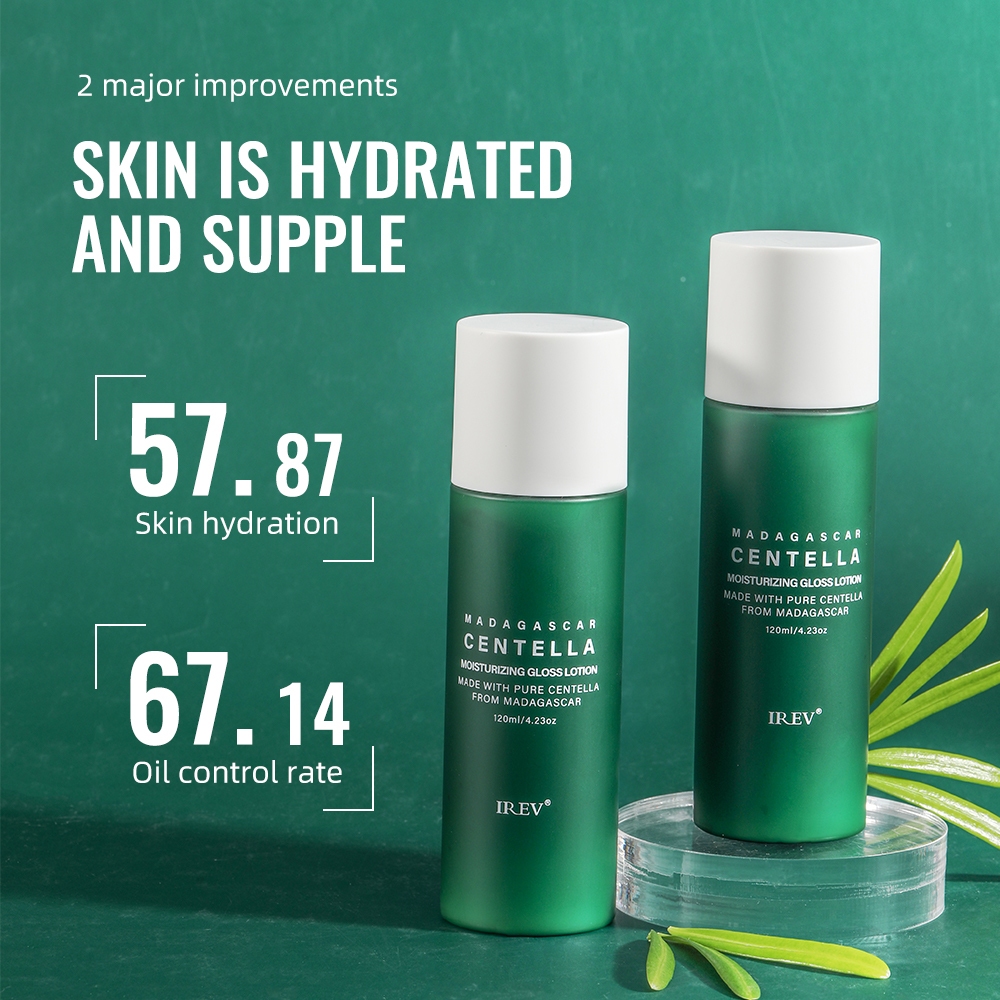 IREV Madagascar Centella Moisturizing Gloss Lotion Removes Acne and ...